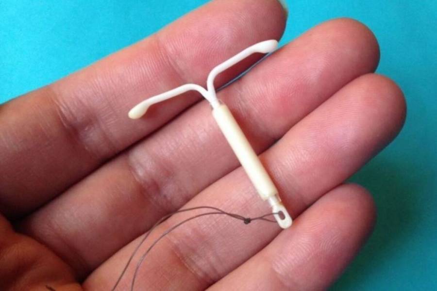 Dispositivos intrauterinos e implantes, anticonceptivos recomendables ...